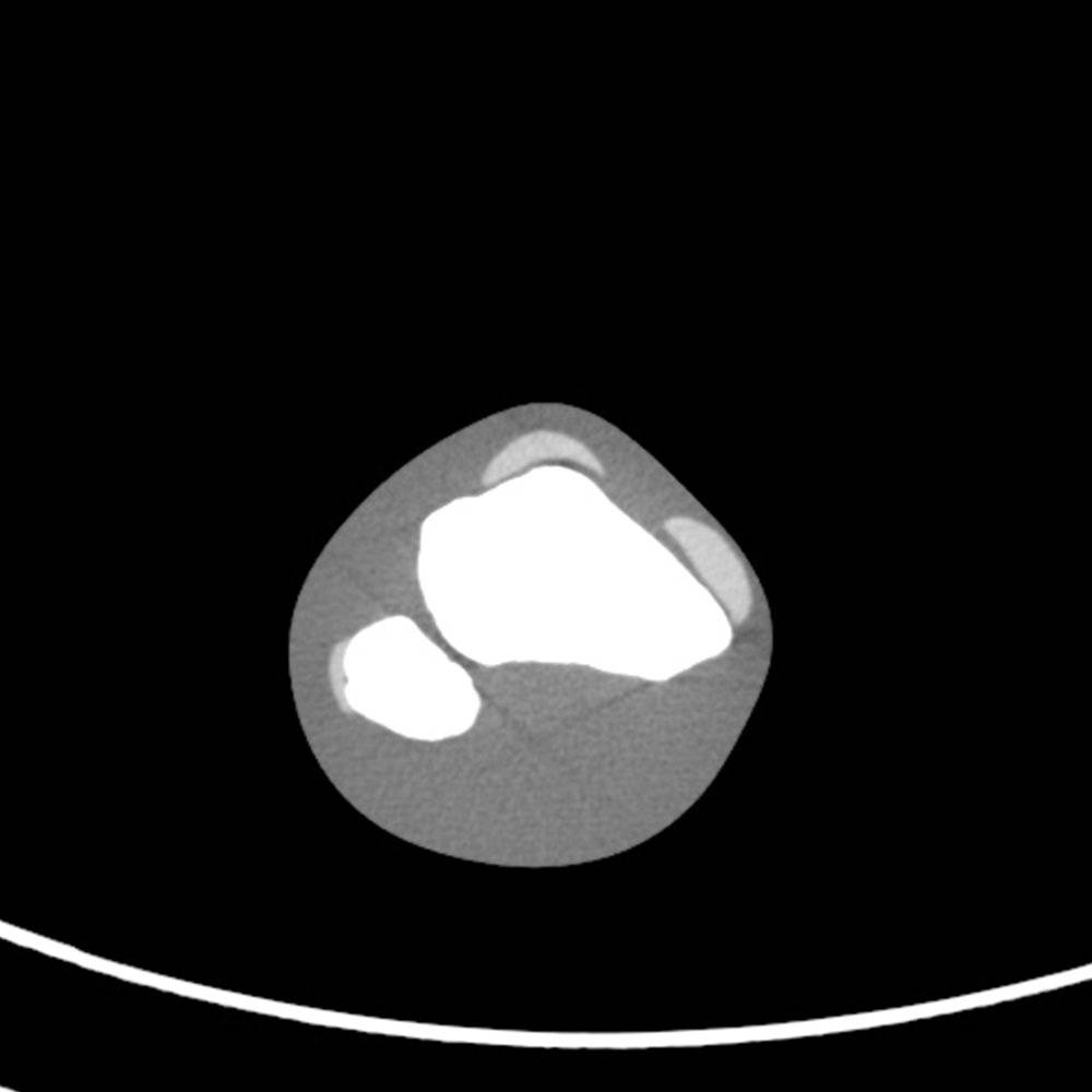 Knee Ligament Phantom - SEM Trainers