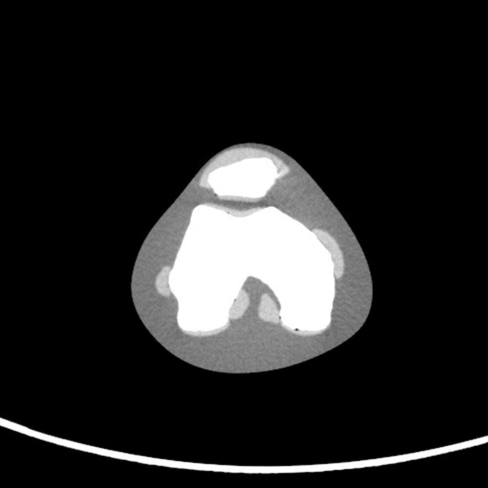 Knee Ligament Phantom - SEM Trainers