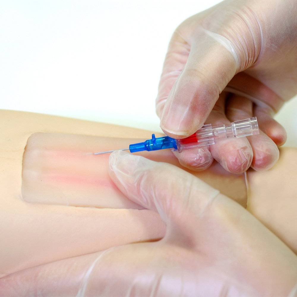 Peripheral Venous Catheter Placement Simulator - SEM Trainers