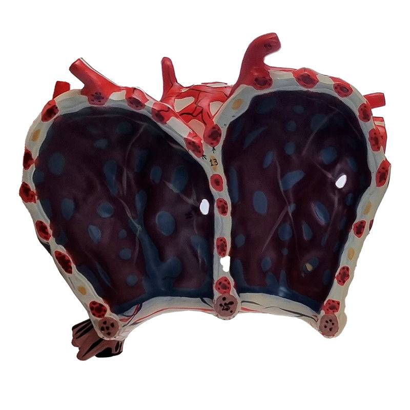 Pulmonary Alveolus Model, 1000X Enlarged - SEM Trainers