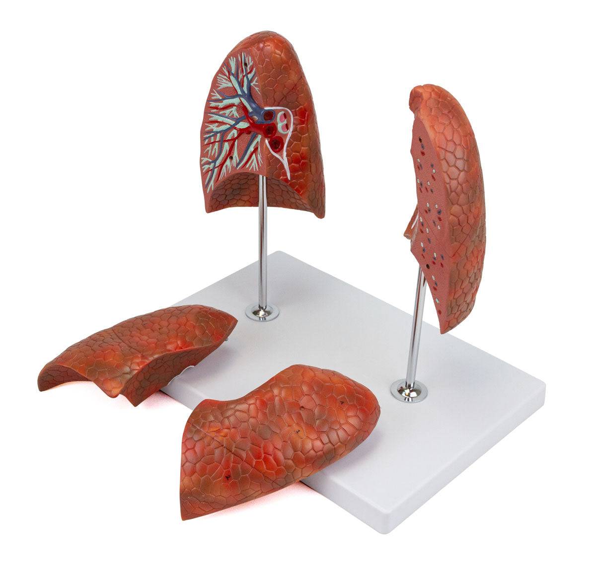 Lung Model, 4 Parts - SEM Trainers